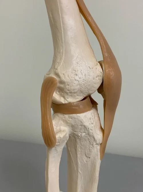 Types of Knee Replacement — Mr Murali Krishnan | Specialist Hip and ...