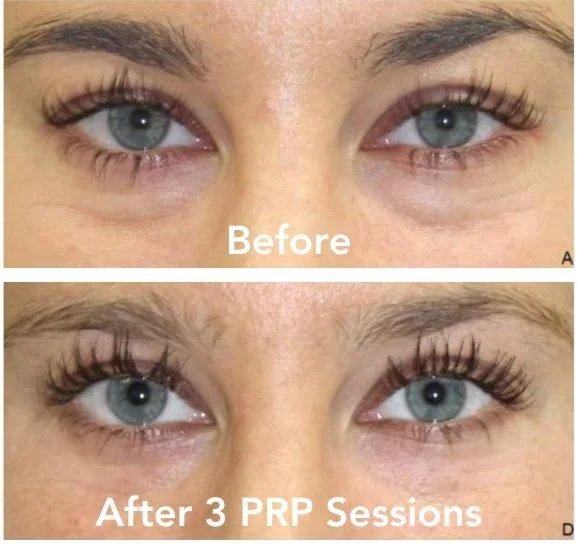 Dermatologist Explains: EZ Gel Under Eye