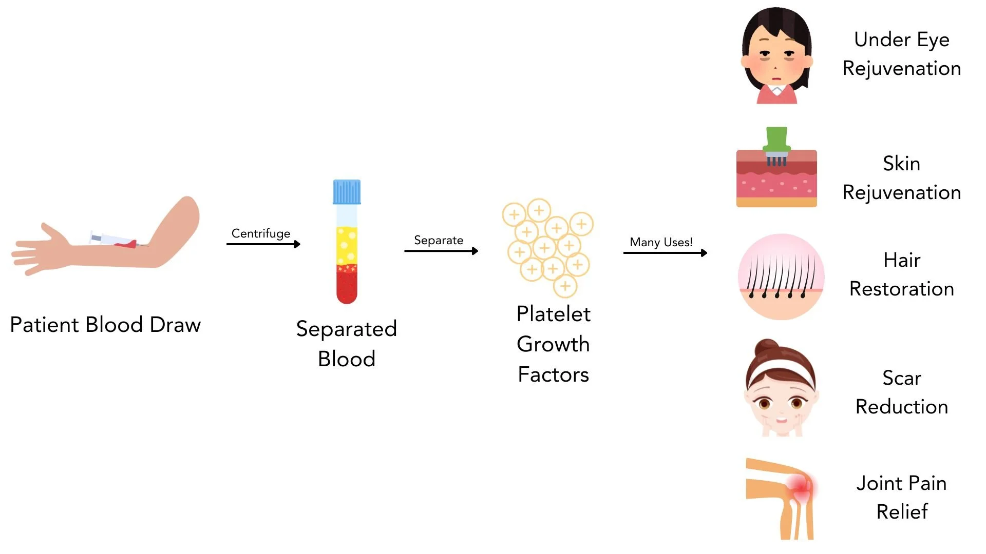Dermatologist Reveals: Under Eye PRP Before and After