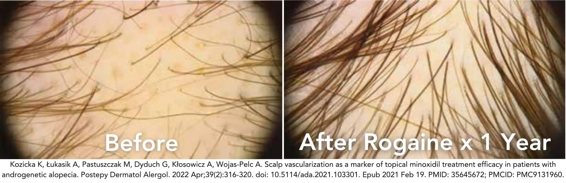 Doctor’s Note: Your Essential Guide to Oral Minoxidil