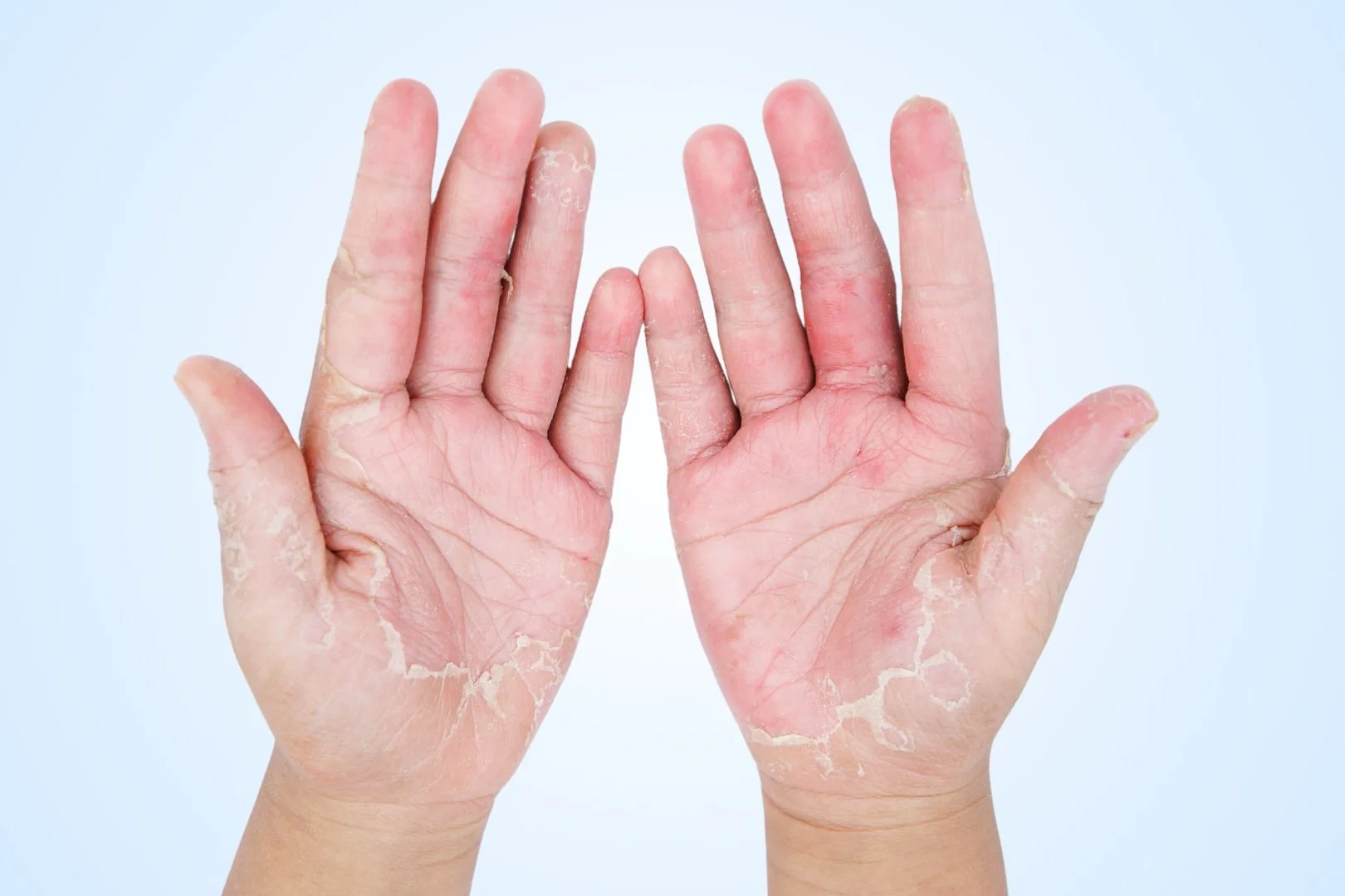 Moisturizing Hand Soap: Favs from a Dermatologist