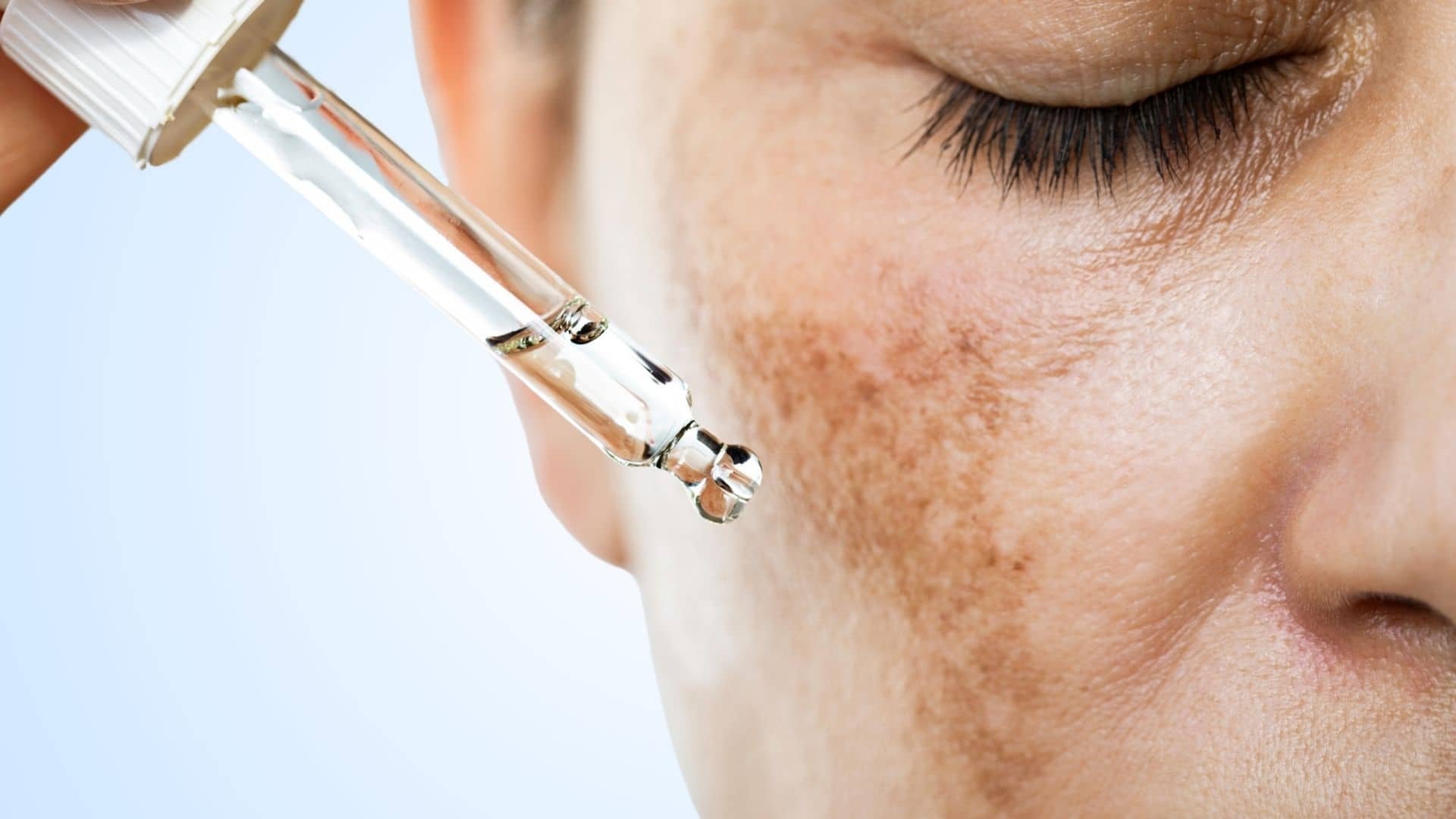 Doctor’s Note: Your Easy + Essential Guide to Melasma