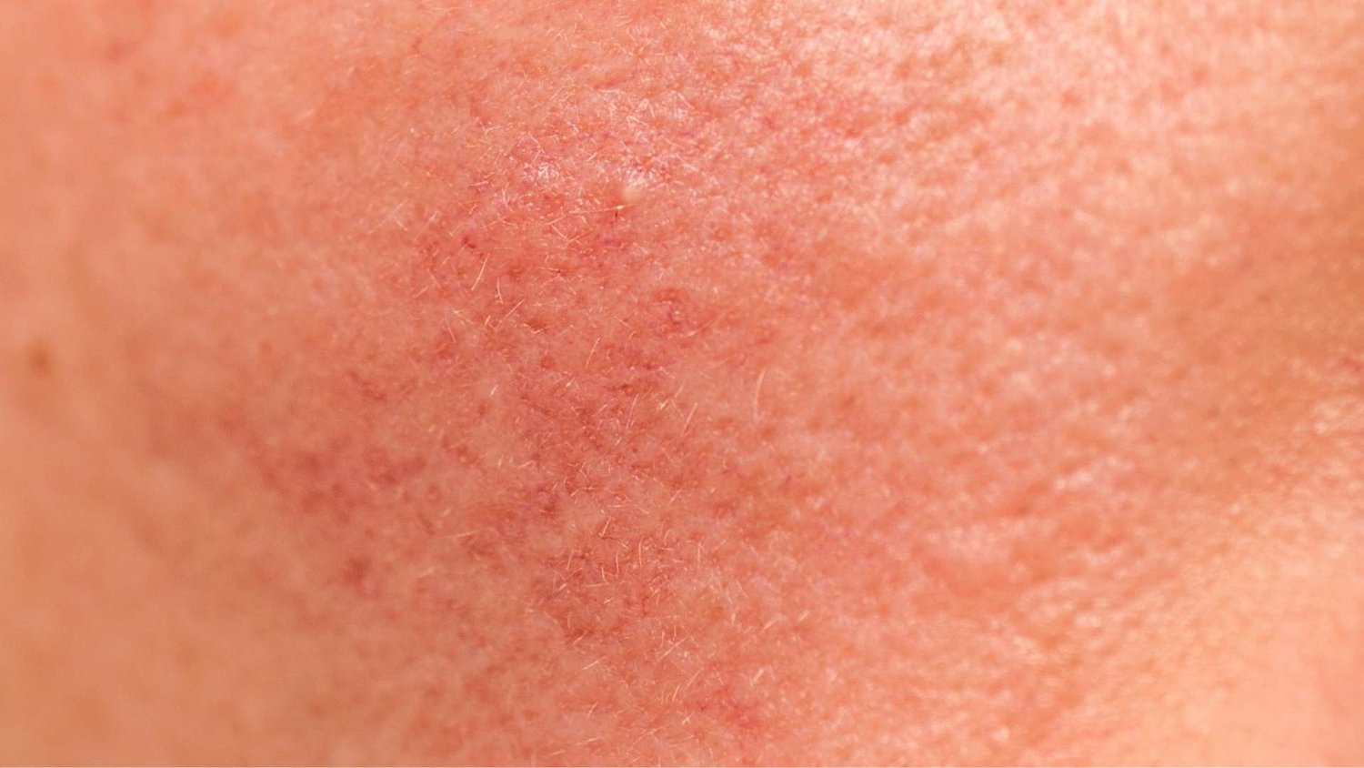 Doctor’s Note: Your Essential Guide to Tranexamic Acid