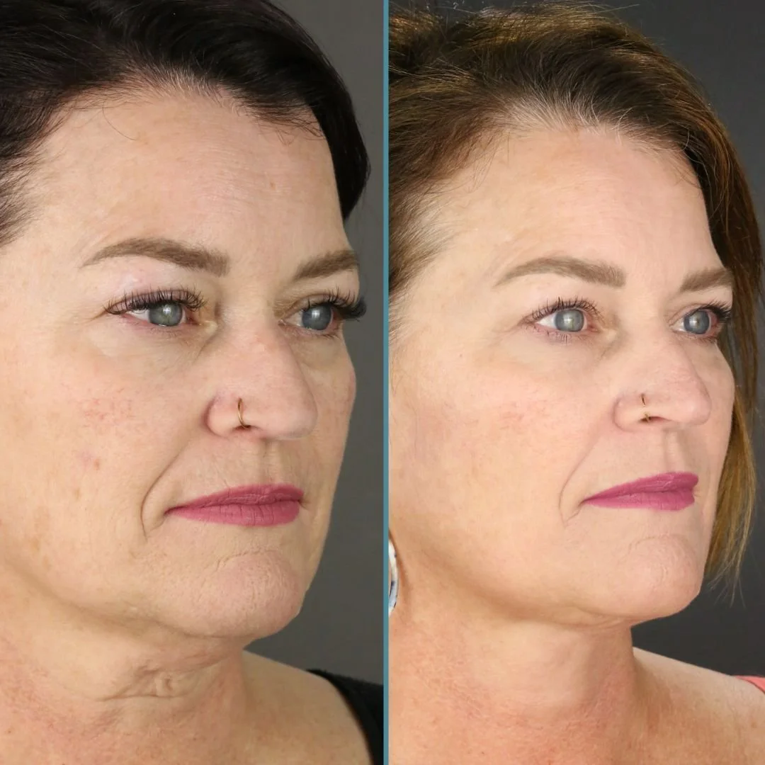 Newman Plastic Surgery