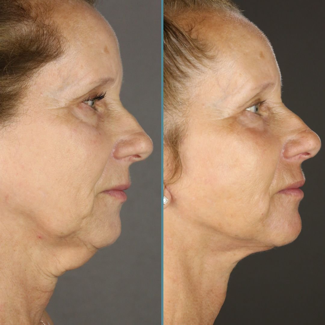 Newman Plastic Surgery