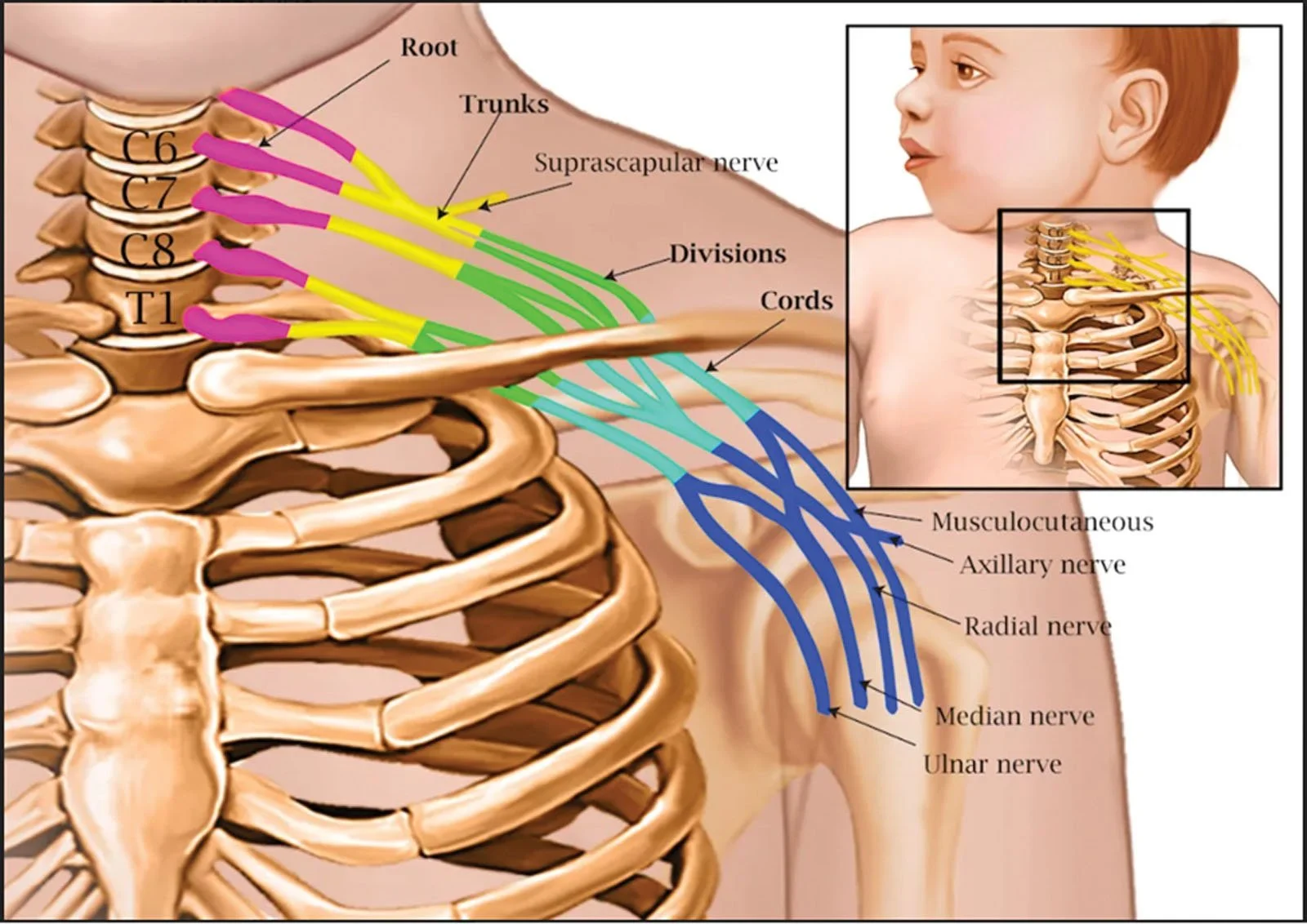 About Birth Injuries | Support Starts Here — United Brachial Plexus ...