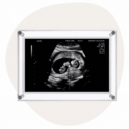 Peek Ultrasound - 2D, 3D, 4D + HD Live Ultrasound