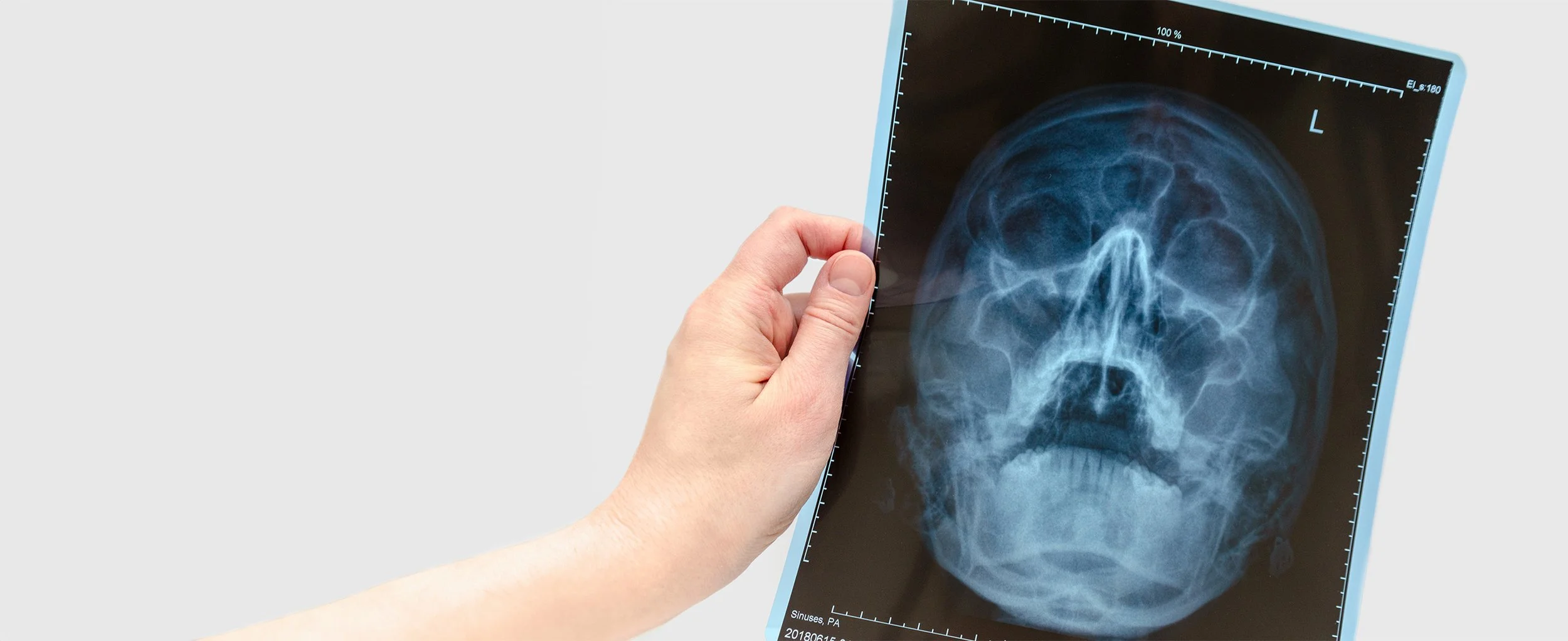 Nose Conditions — ENT Care Hub | Dr Hannah North | Dr Rhydian Harris ...