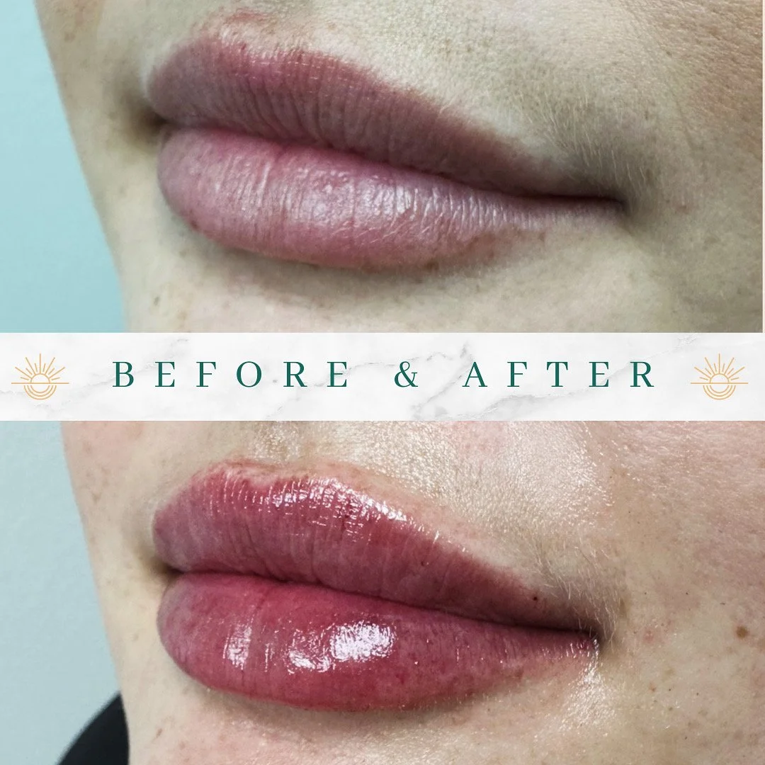 Services 1 — GLOWTOX