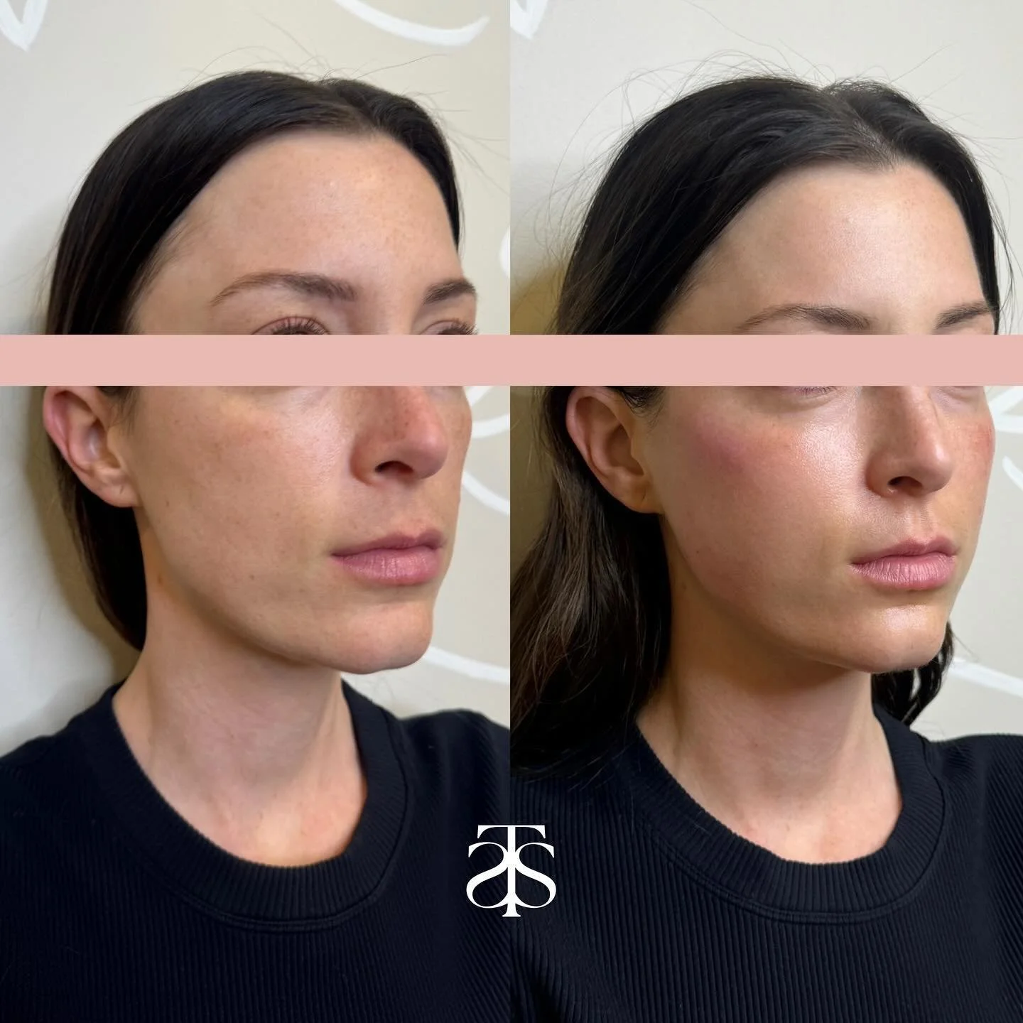 The Skin Scene Aesthetics