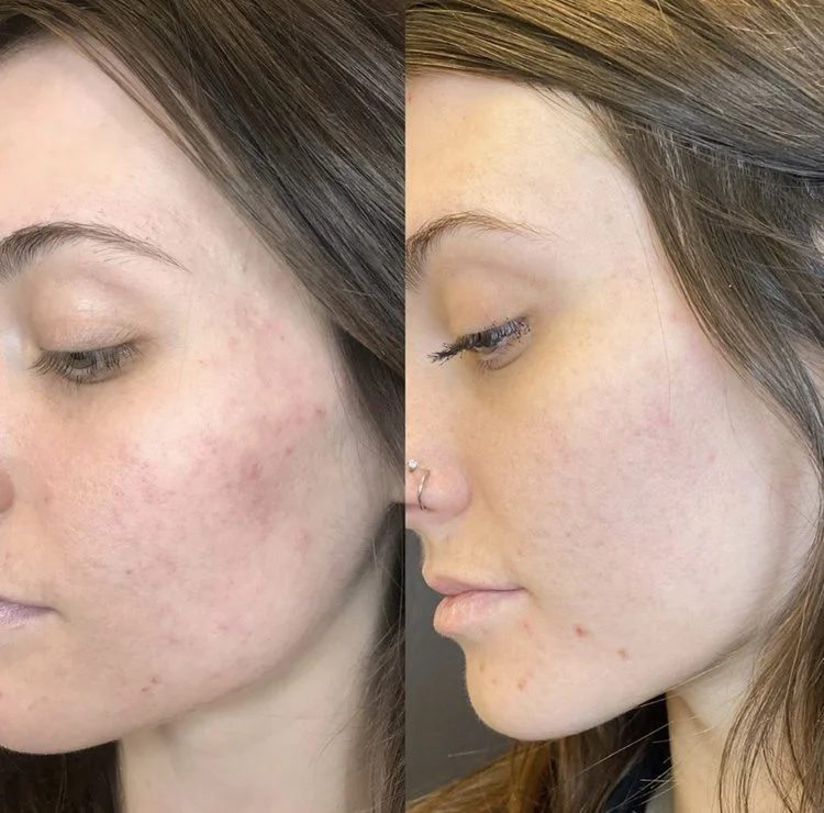 Skin Services | Enhance Skin Now — The Skin Scene Aesthetics