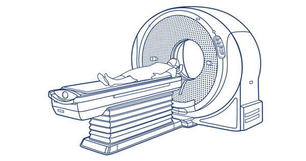 PsiF - Posterior SI Fusion — Omnia Medical