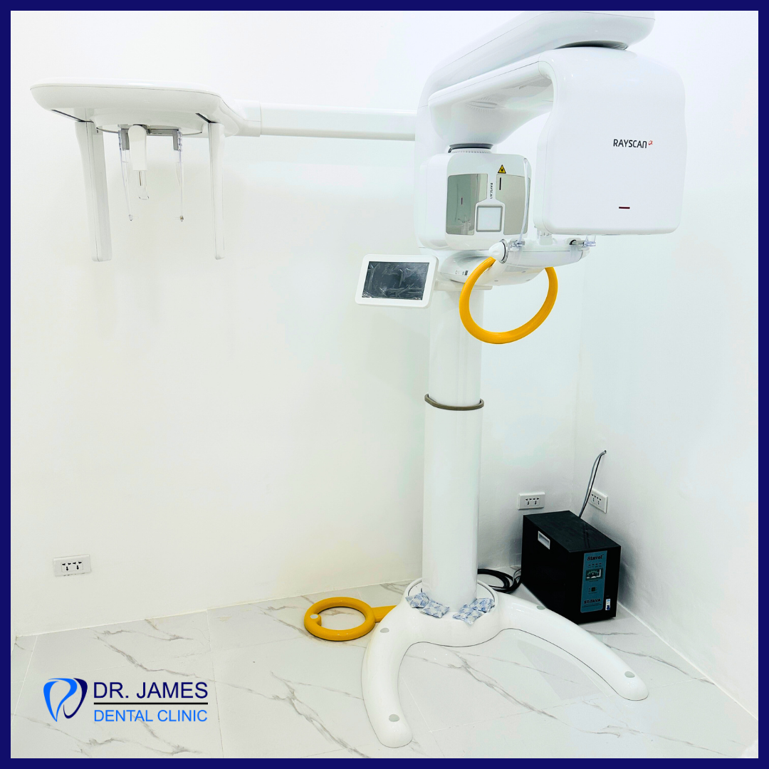 Dental Xray — Dr. James Dental Clinic