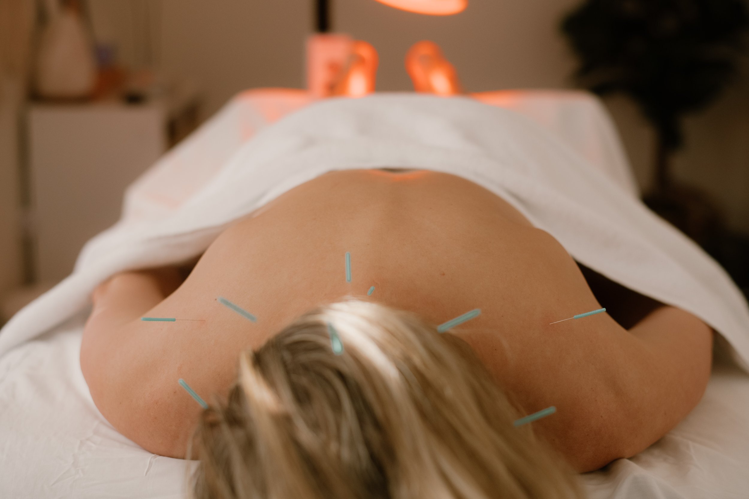 What is Esoteric Acupuncture? | Magnolia Wellness OC