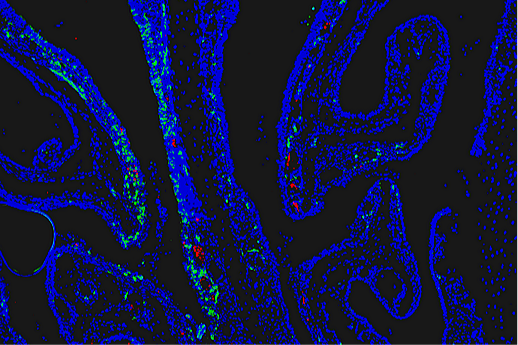 Research — Laboratory of Respiratory Immunology