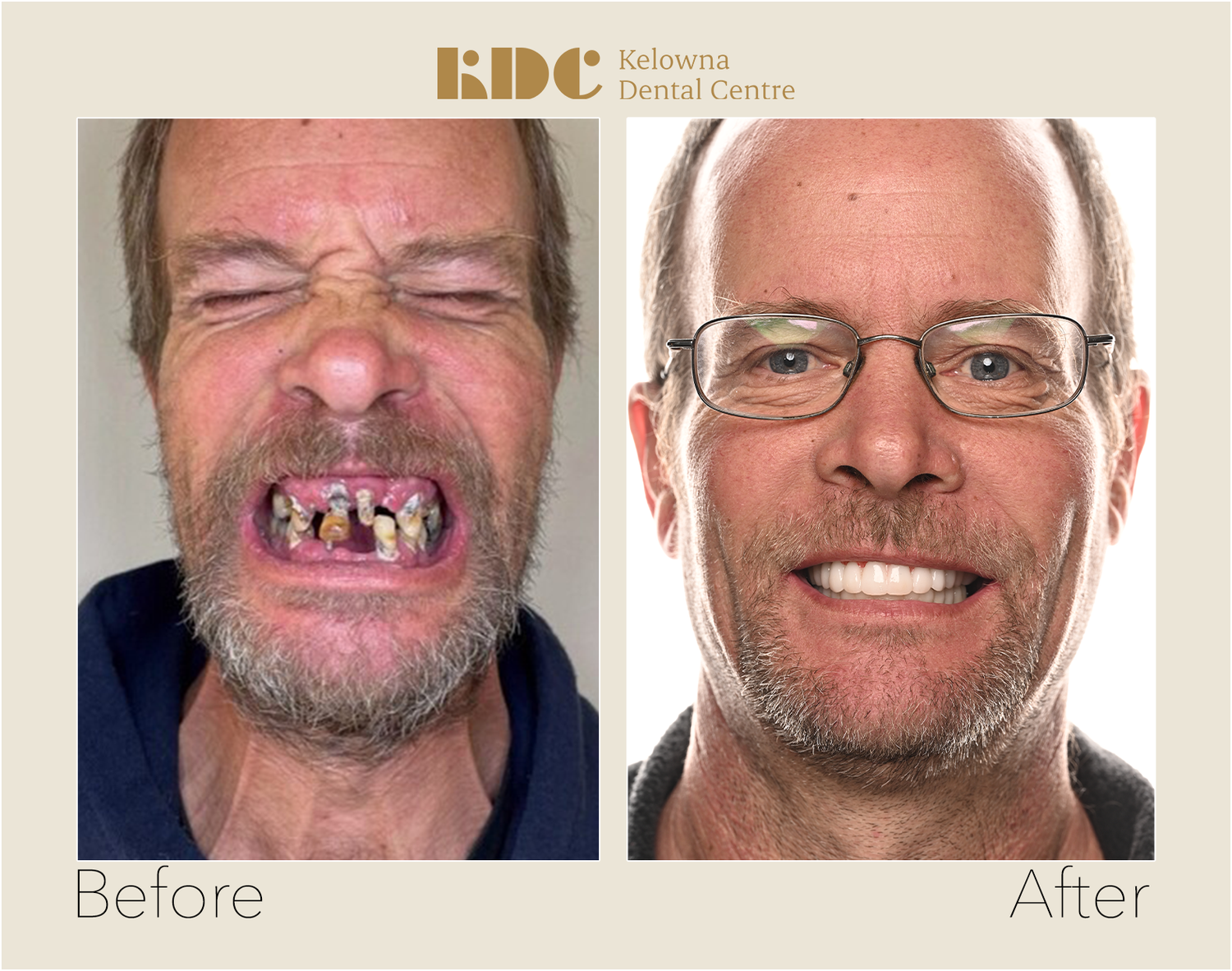 Dr. Michael Webster, Kelowna Dental Centre - Canada