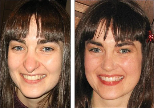 Choosing the Right Doctor — Denenberg Facial Plastic Surgery