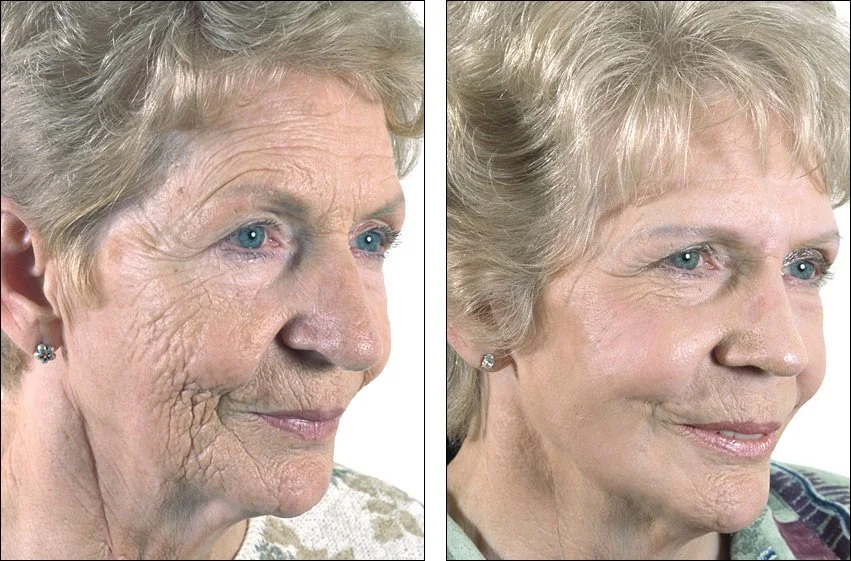 Denenberg Facial Plastic Surgery