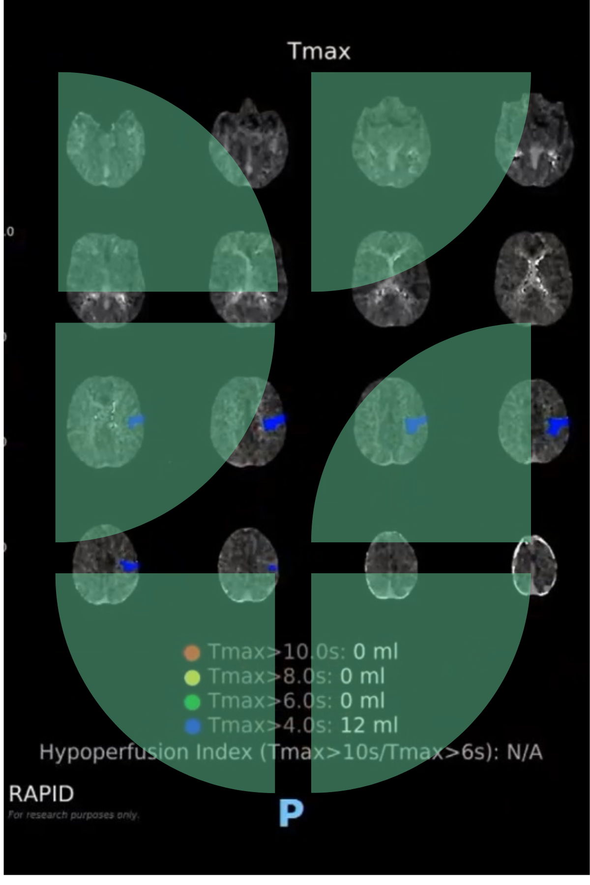 Blog — Imaging Conferences To Go
