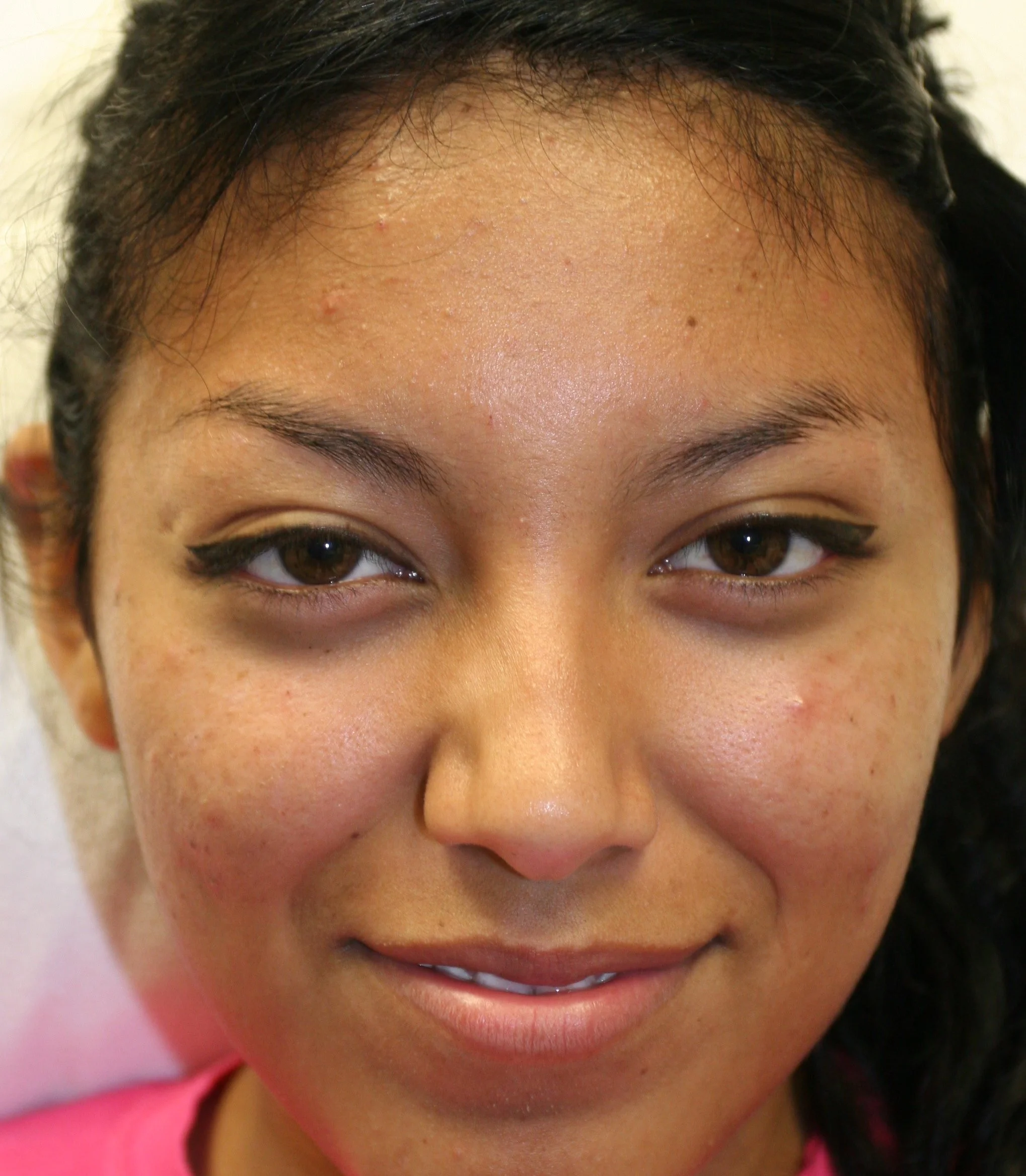 PHF Alumni — Project Happy Face