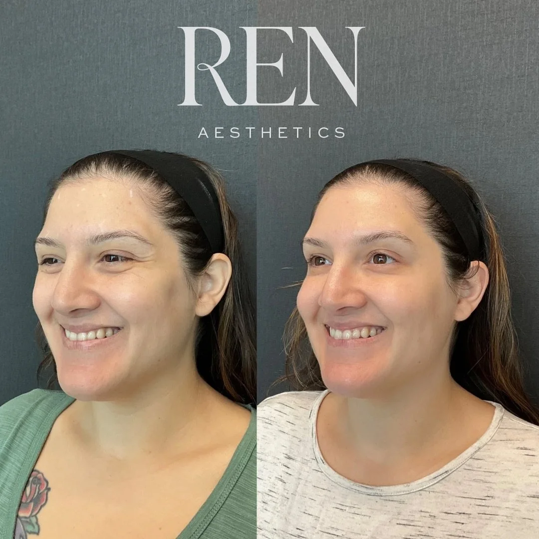 About — Ren Aesthetics