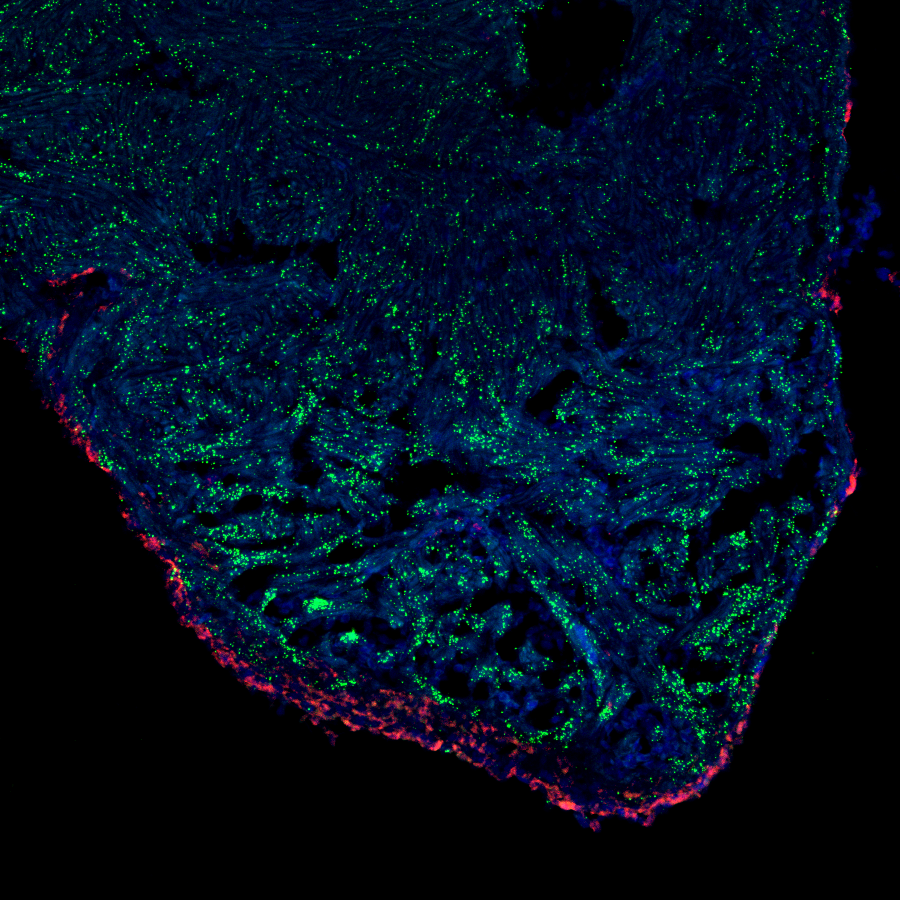 ECM in Heart Regeneration — THE TARGOFF LAB