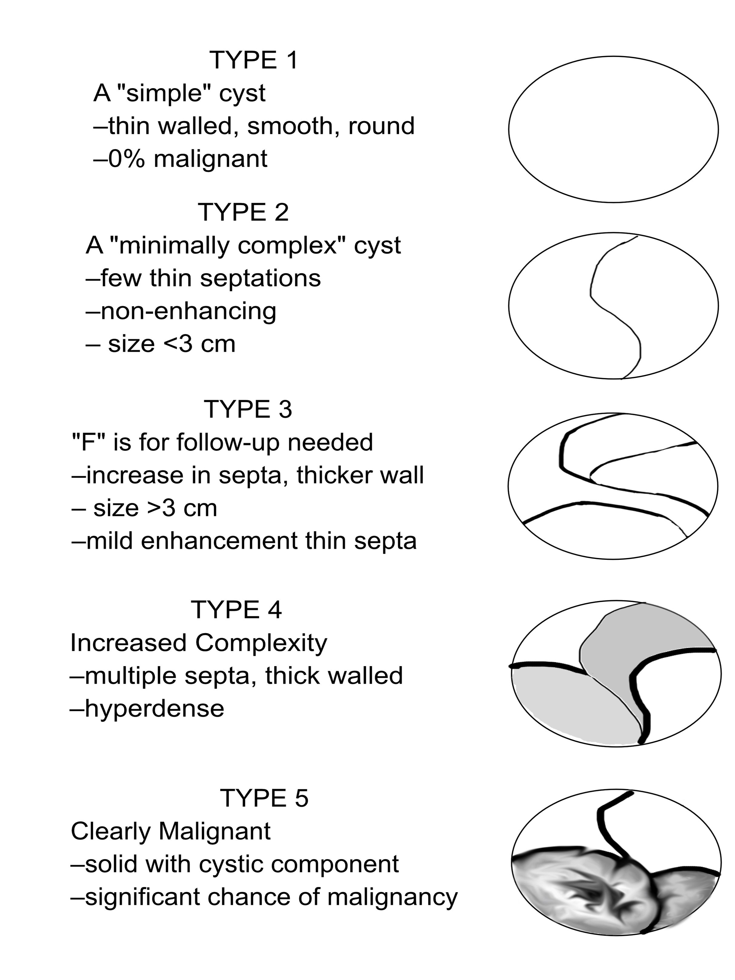 Kidney Cysts — TB Urology