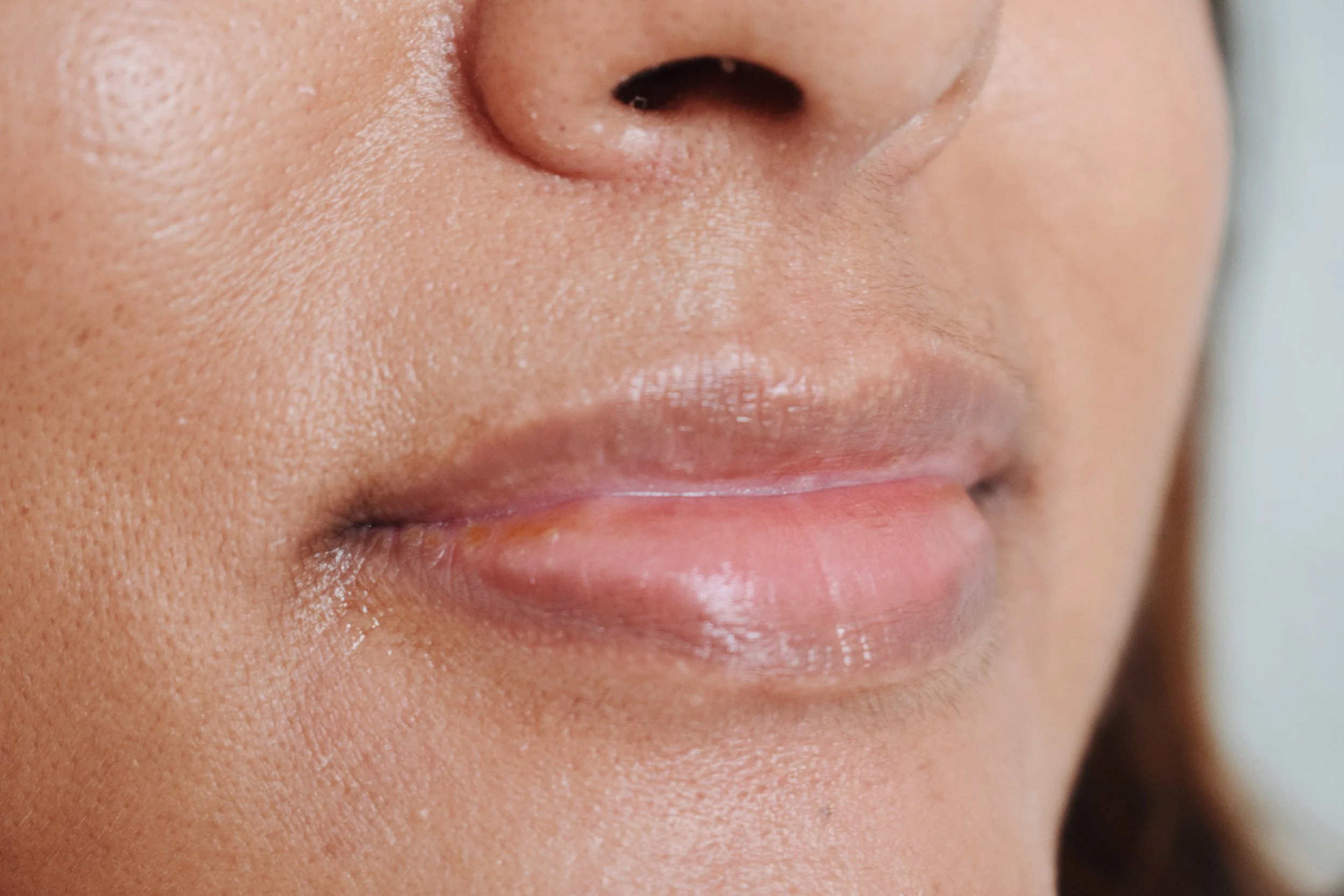How to Treat “Two-Toned” Lips: Tips From Someone Who Learned to Love ...