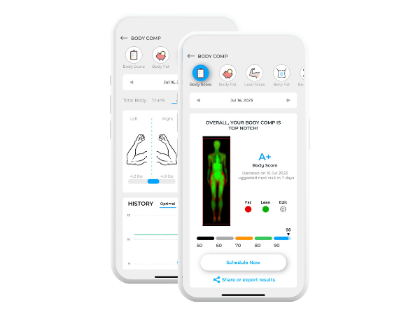 AI-Enhanced DEXA Body Scans in Johannesburg, South Africa — DexaFit ...