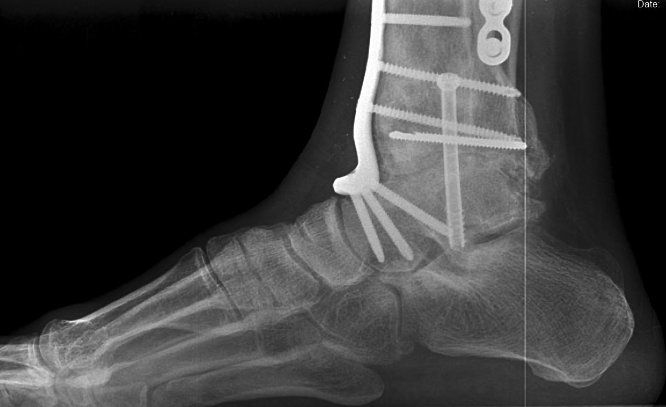 Joseph Waterhouse DPM FACFAS | Schedule Your Consultation Now