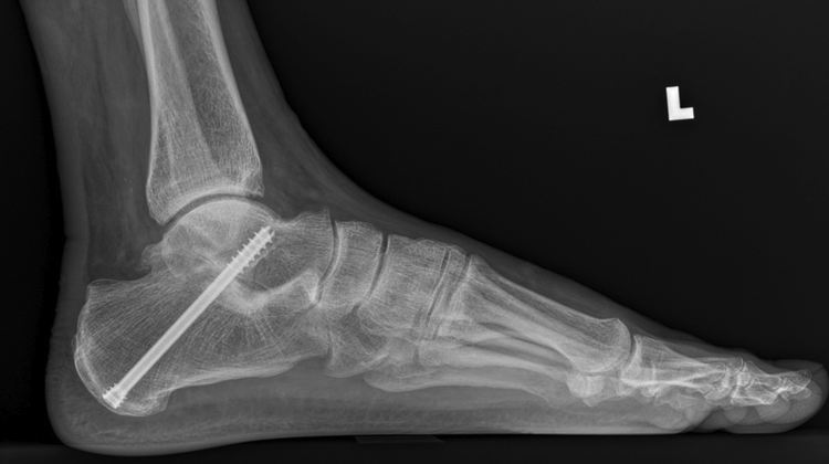 Joseph Waterhouse DPM FACFAS | Schedule Your Consultation Now