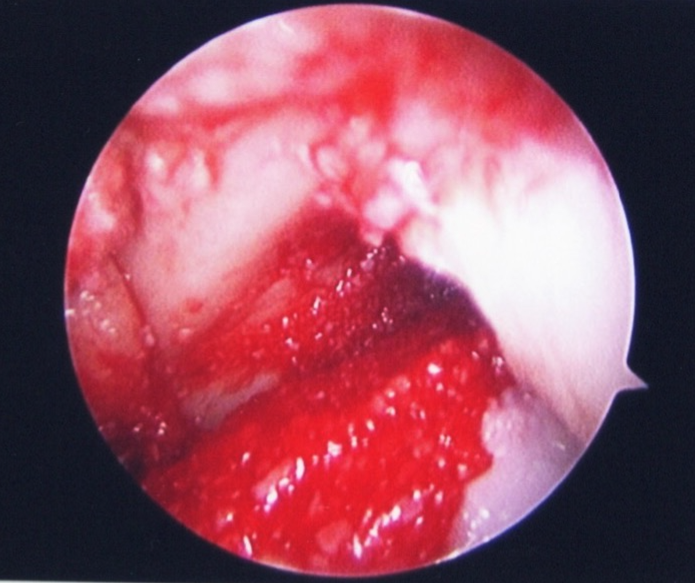 Joseph Waterhouse DPM FACFAS | Schedule Your Consultation Now