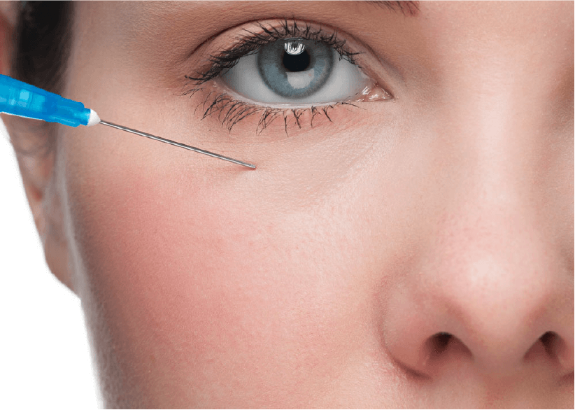 Tear Trough Filler - Under‑Eye & Dark Circle Treatment | Harley Street ...
