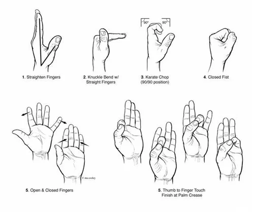 Digital Mucous Cyst Surgery Info — David Holt, M.D.