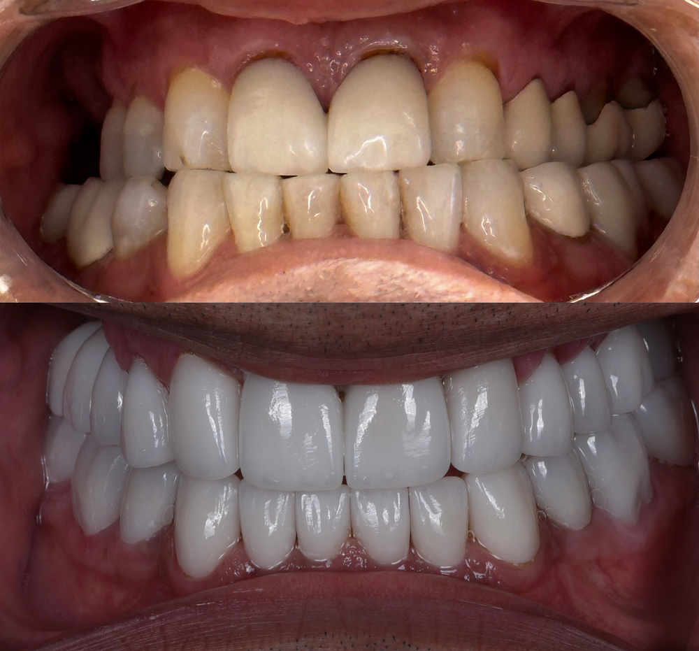 Dentist in Randolph, NJ | Revive Dental Studio