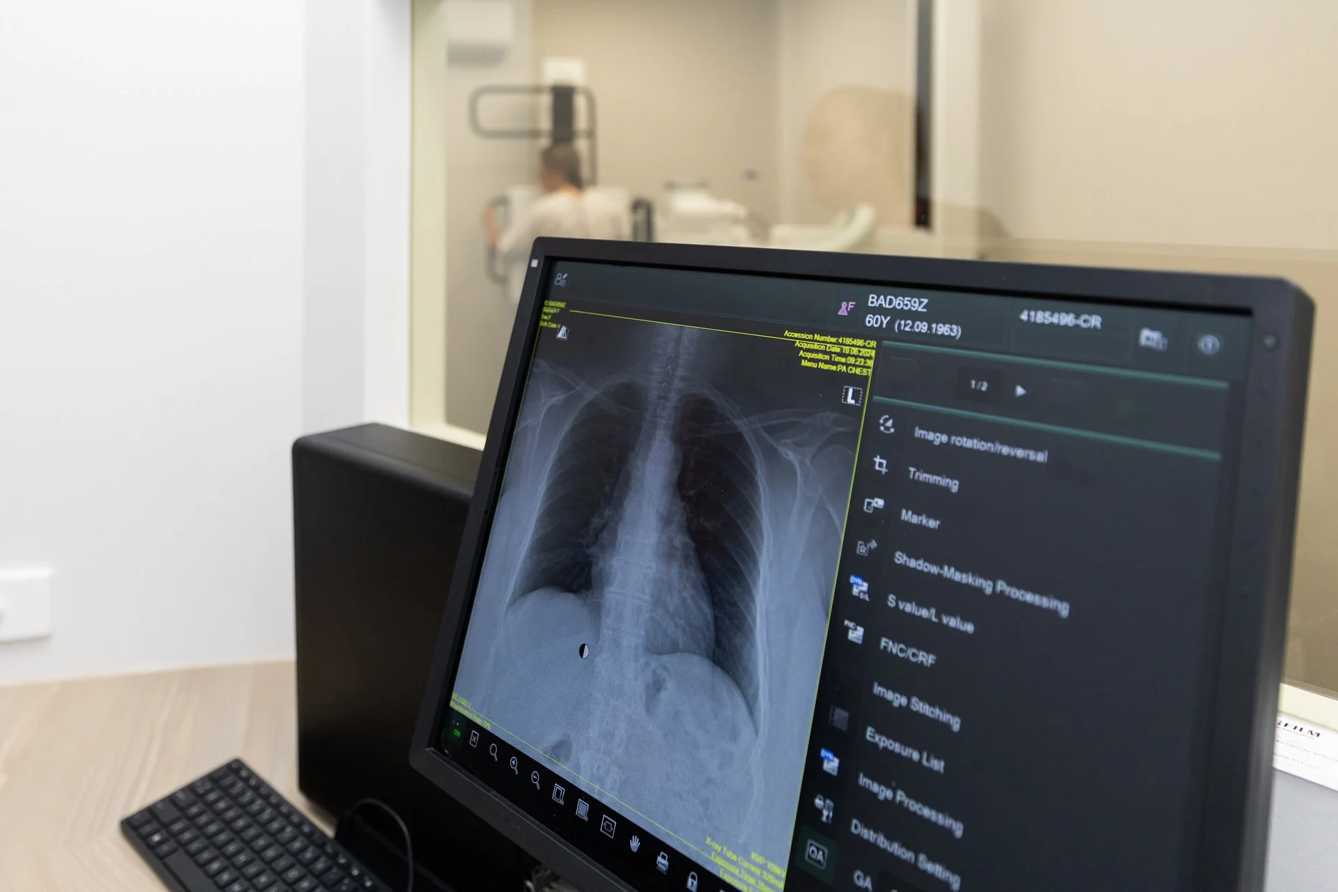 General X-Ray — Bendigo Radiology