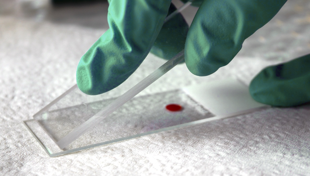 RapidSmear™ - HemaGlobal