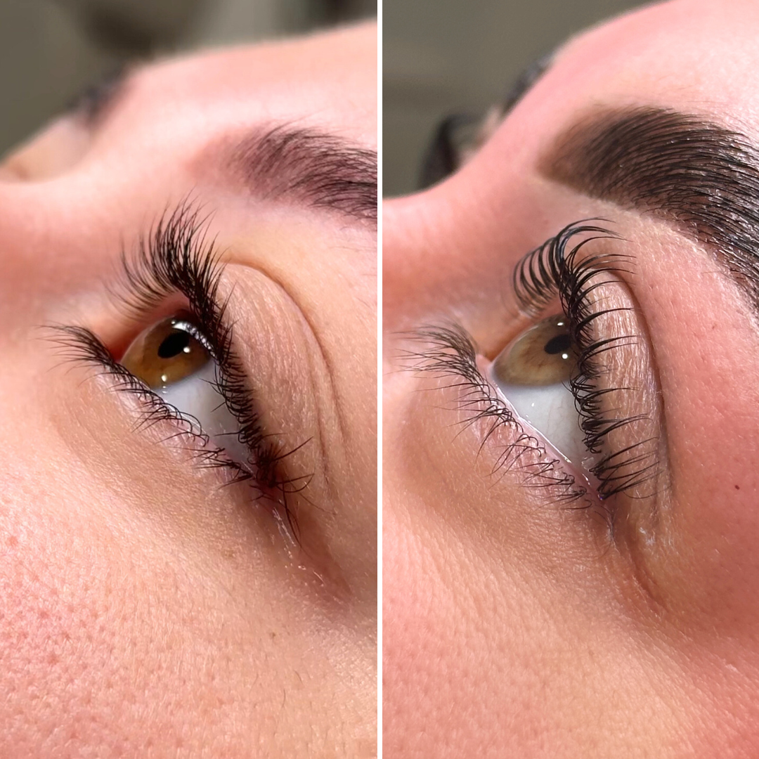 Services 4 — TB Aesthetics