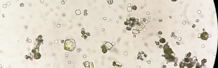 Pain, Uric Acid, and Immune Defense: A Surprising Connection ...