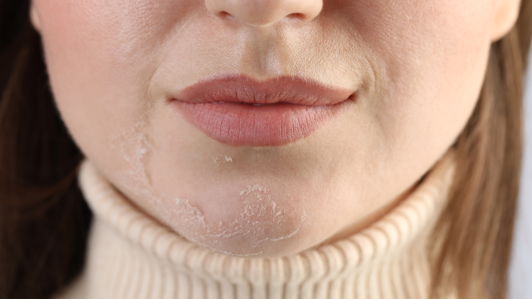 The Impact of Weather on Dry Skin: How to Adjust Your Routine — OA ...