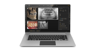 Sidexis Viewer Enhance Diagnostic Precision Today New Standard Imaging