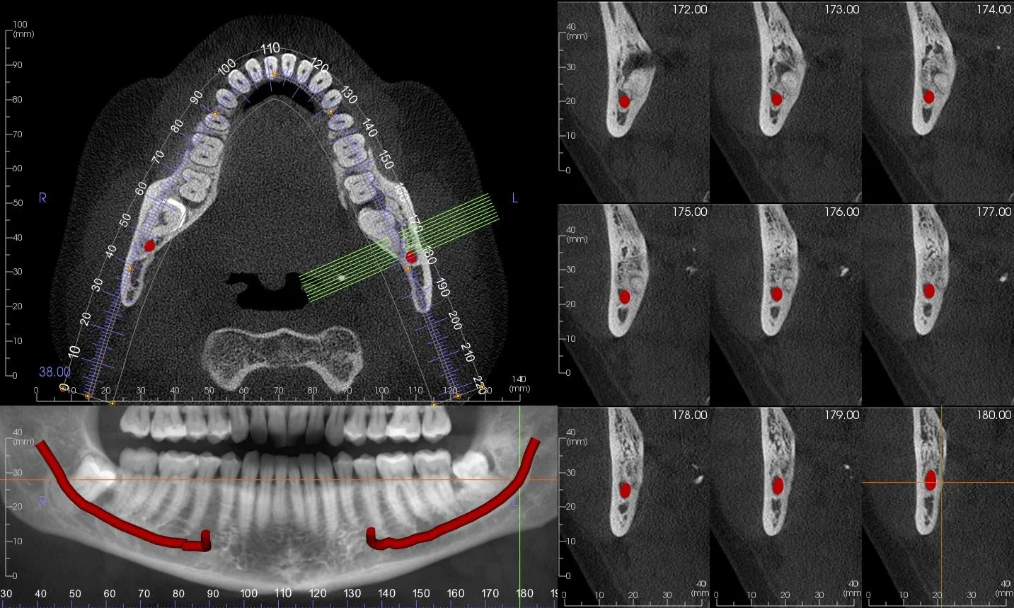 Dental Imaging Center in Vancouver B.C., 3D Imaging, Cone Beam Computed Tomography, Radiology ...