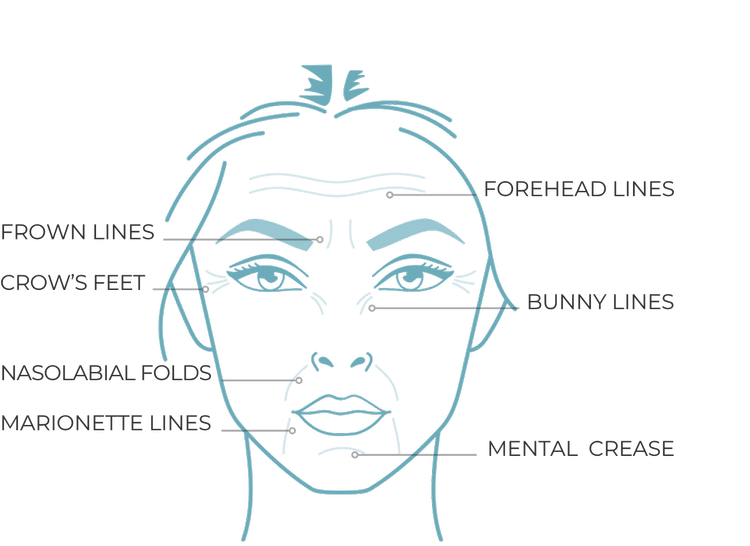Wrinkles & Lines | Revitalize Your Skin Today — True Balance Medical ...