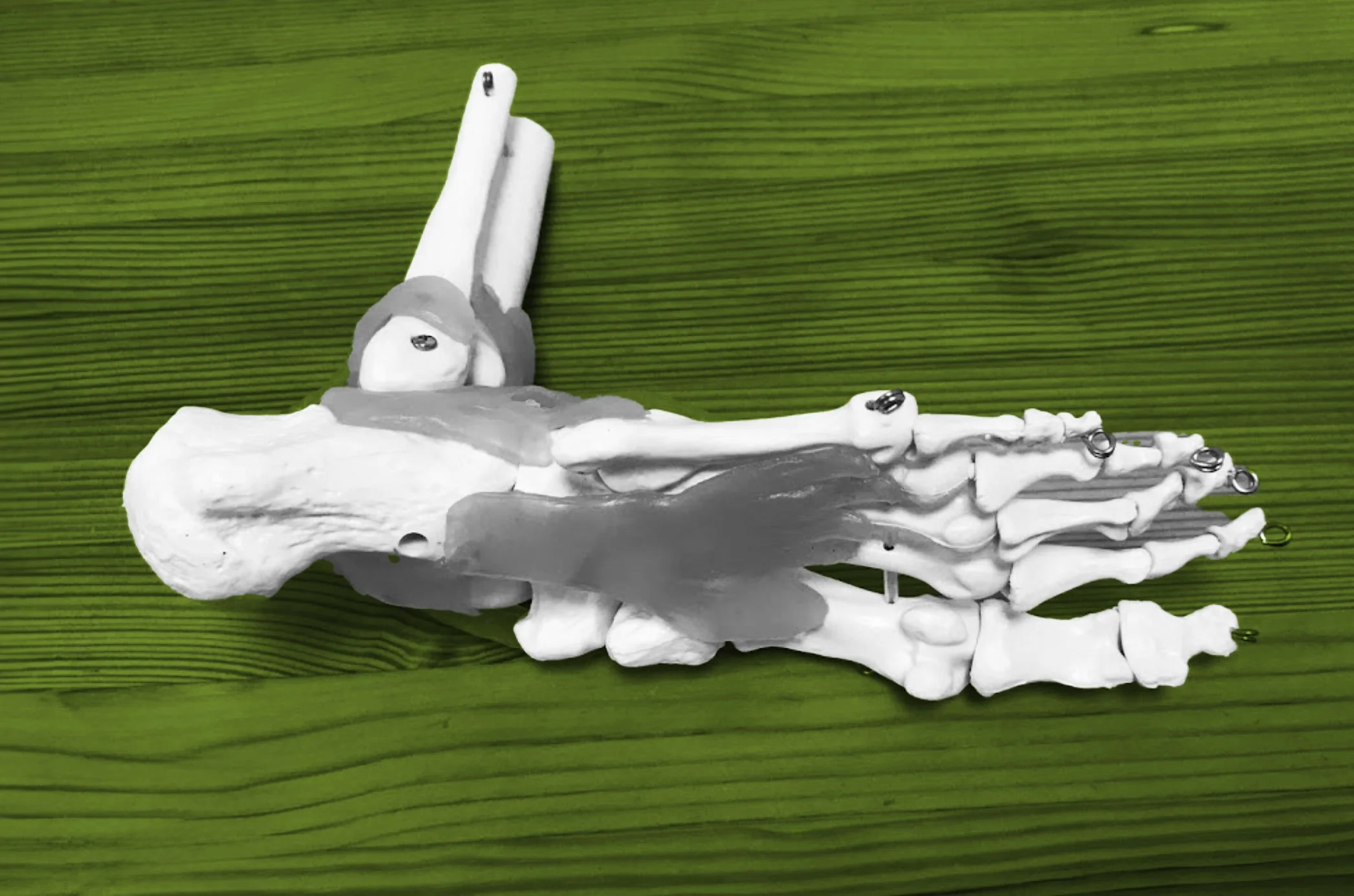 Foot Forte | Podiatry in Aviemore