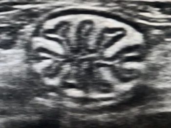 Ultrasound — Barrowman Goodman Vets