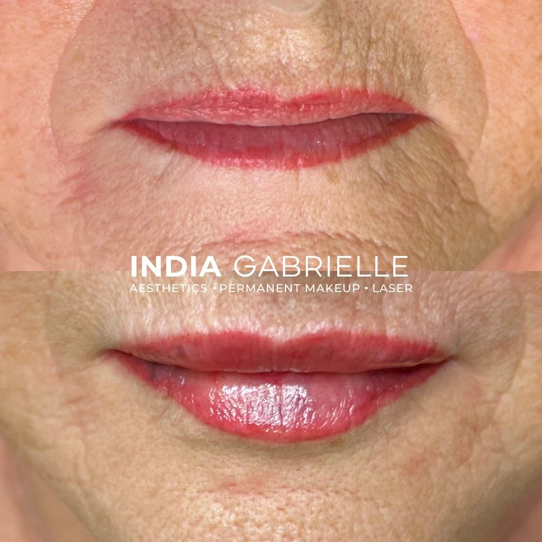 Best Treatments for Dry Lips: Seventy Hyal 2000 Hydration Booster vs ...