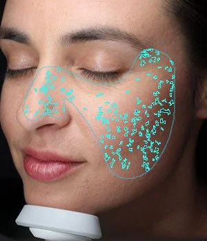 Visia Skin Analysis | Advanced Imaging for Dermatological Analysis ...