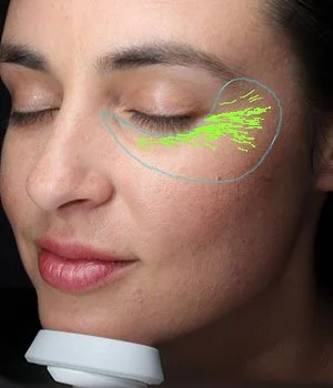 Visia Skin Analysis | Advanced Imaging for Dermatological Analysis ...