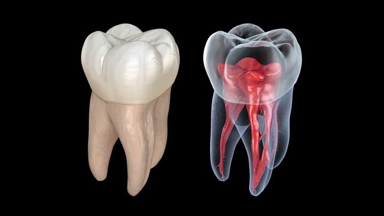 The Role of Cone Beam Computed Tomography (CBCT) in Endodontics — Dr ...