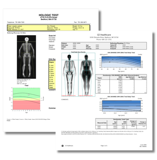 AI-Enhanced DEXA Body Scans in Burlington, Vermont — DexaFit Burlington
